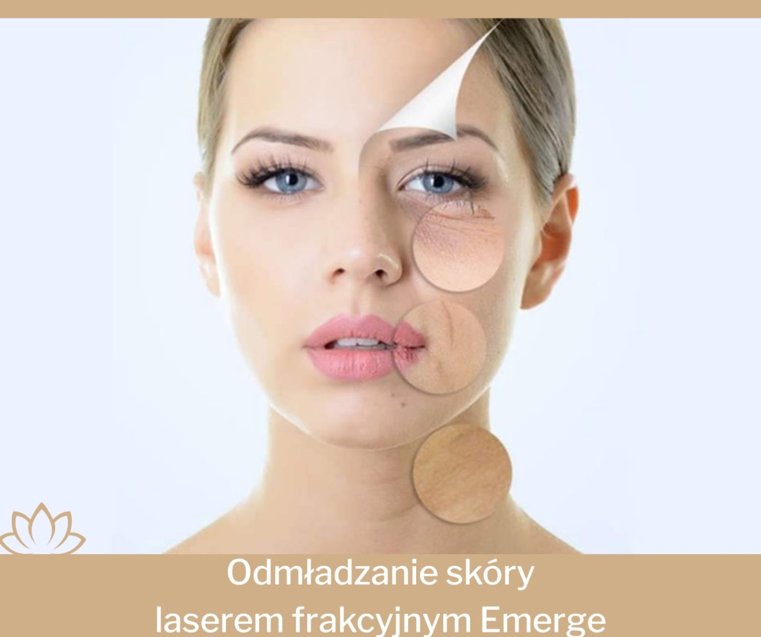 Skóra twarzy z wiekiem traci jędrność. | Medica Laser