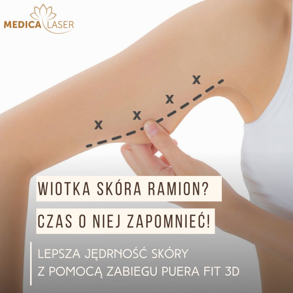Czas zapomnieć o wiotkiej skórze ramion | Medica Laser